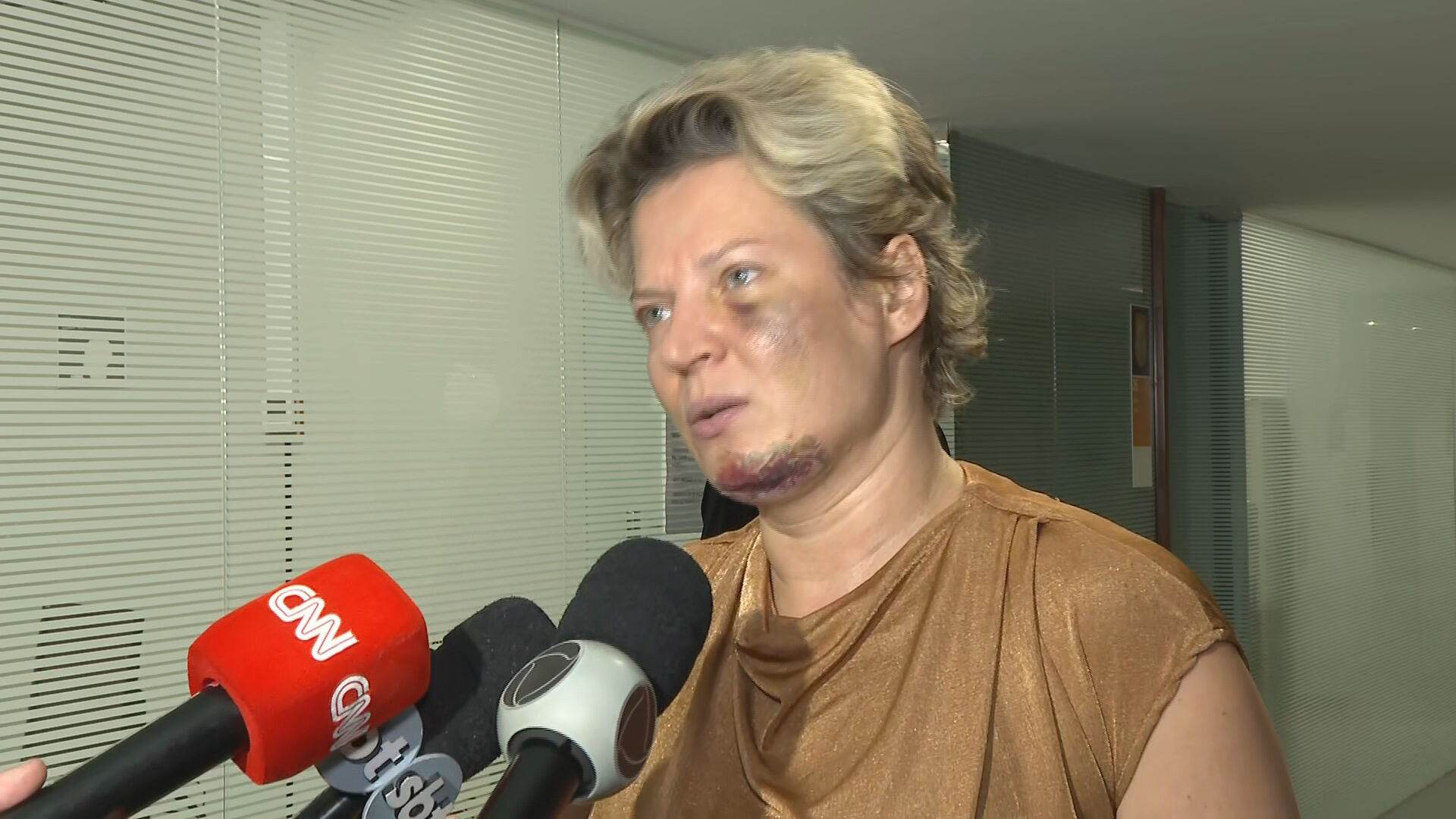 Laudo da polícia do DF não aponta 'lesões recentes' nas mãos de marido ...