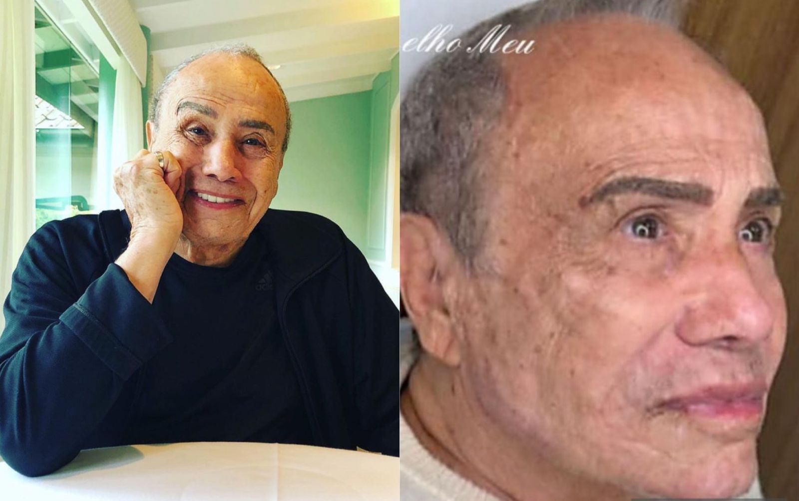 Aos 91 anos, Stênio Garcia passa por transformação e exibe harmonização ...