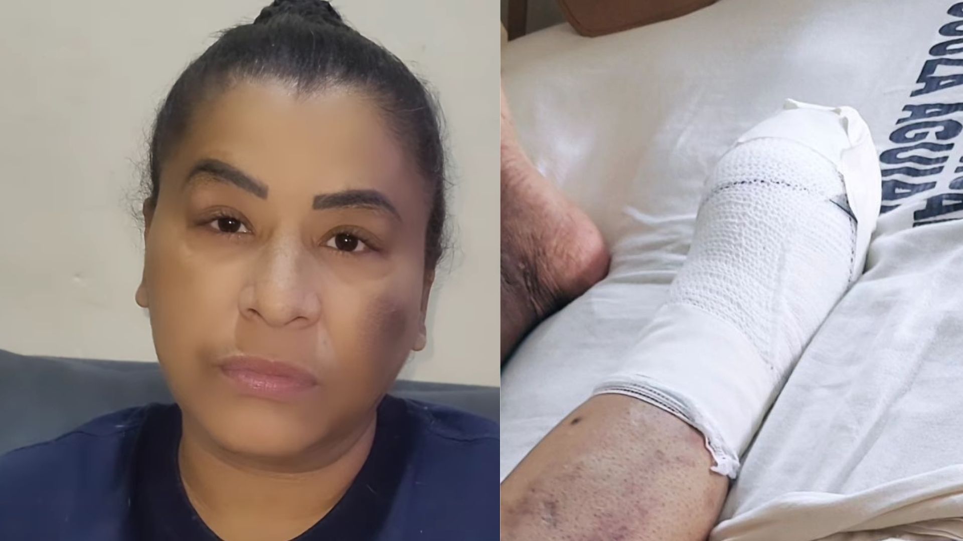 Funkeira MC Katia tem parte do pé amputado após problema de saúde | CNN ...