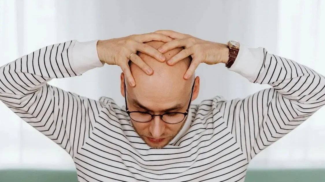 Top 20 da calvície: confira a lista dos países com mais homens carecas ...