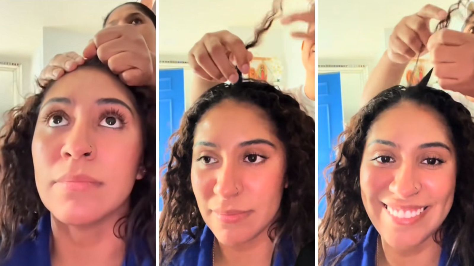 Hair Popping: puxar o cabelo para aliviar a dor de cabeça traz riscos à ...