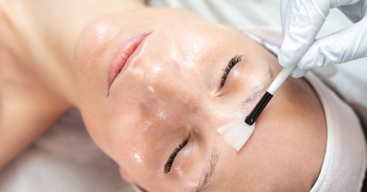 Peeling: veja os diferentes tipos e os cuidados que cada procedimento ...