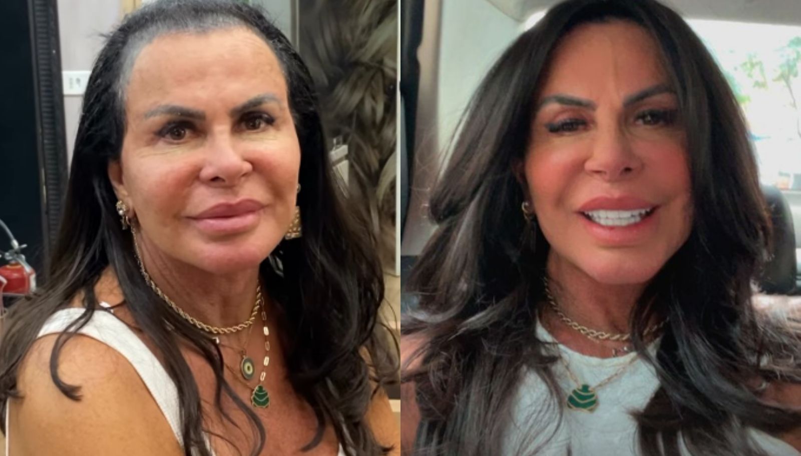 Gretchen mostra transformação do visual ao colocar nova prótese capilar ...