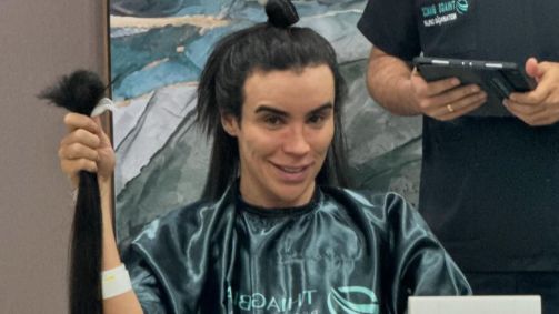 Rafa Uccman raspa cabelo e mostra resultado: "Menos uma calva" | CNN Brasil