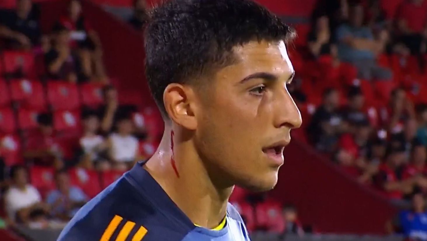 Caco de vidro acerta pescoço de goleiro do Boca Juniors, que sangra ...