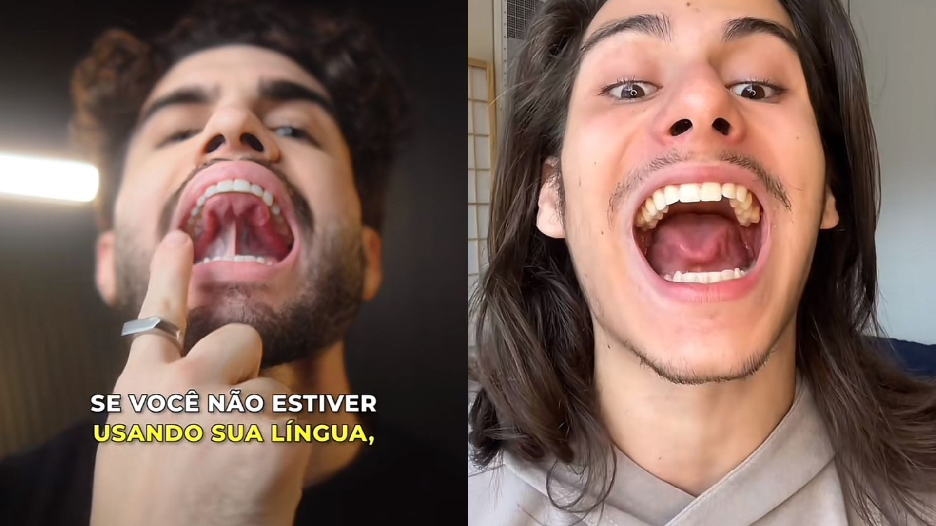 Mewing define a mandíbula? Conheça riscos do exercício viral do TikTok ...
