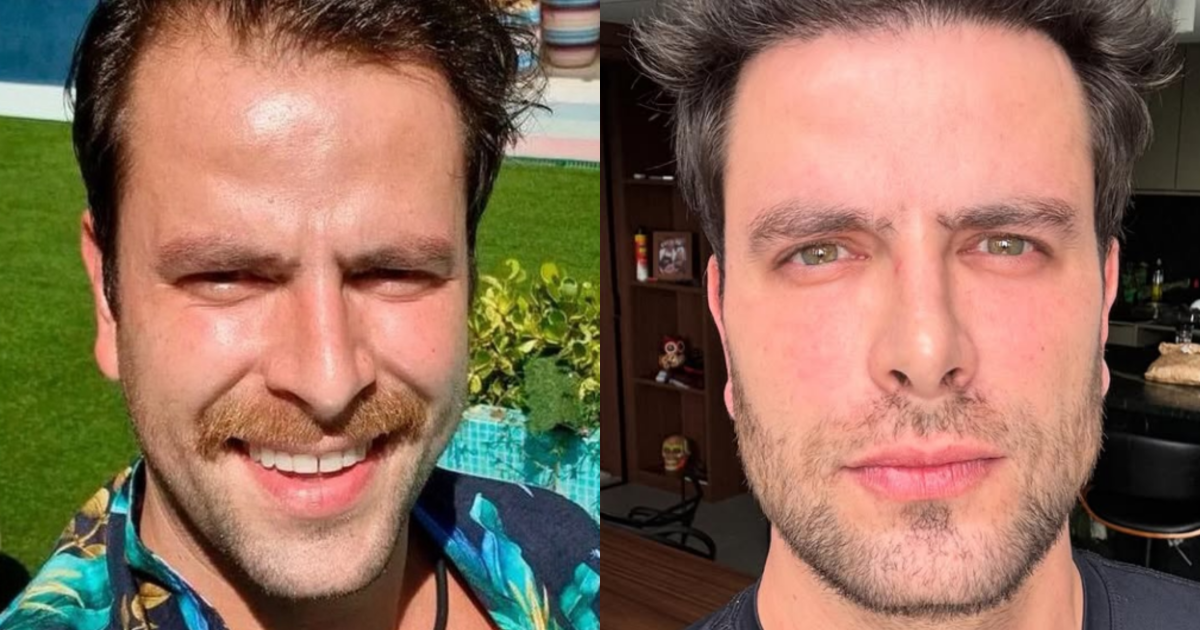 Ex-BBB Gustavo celebra harmonização facial: "Ainda não acabou" | CNN Brasil