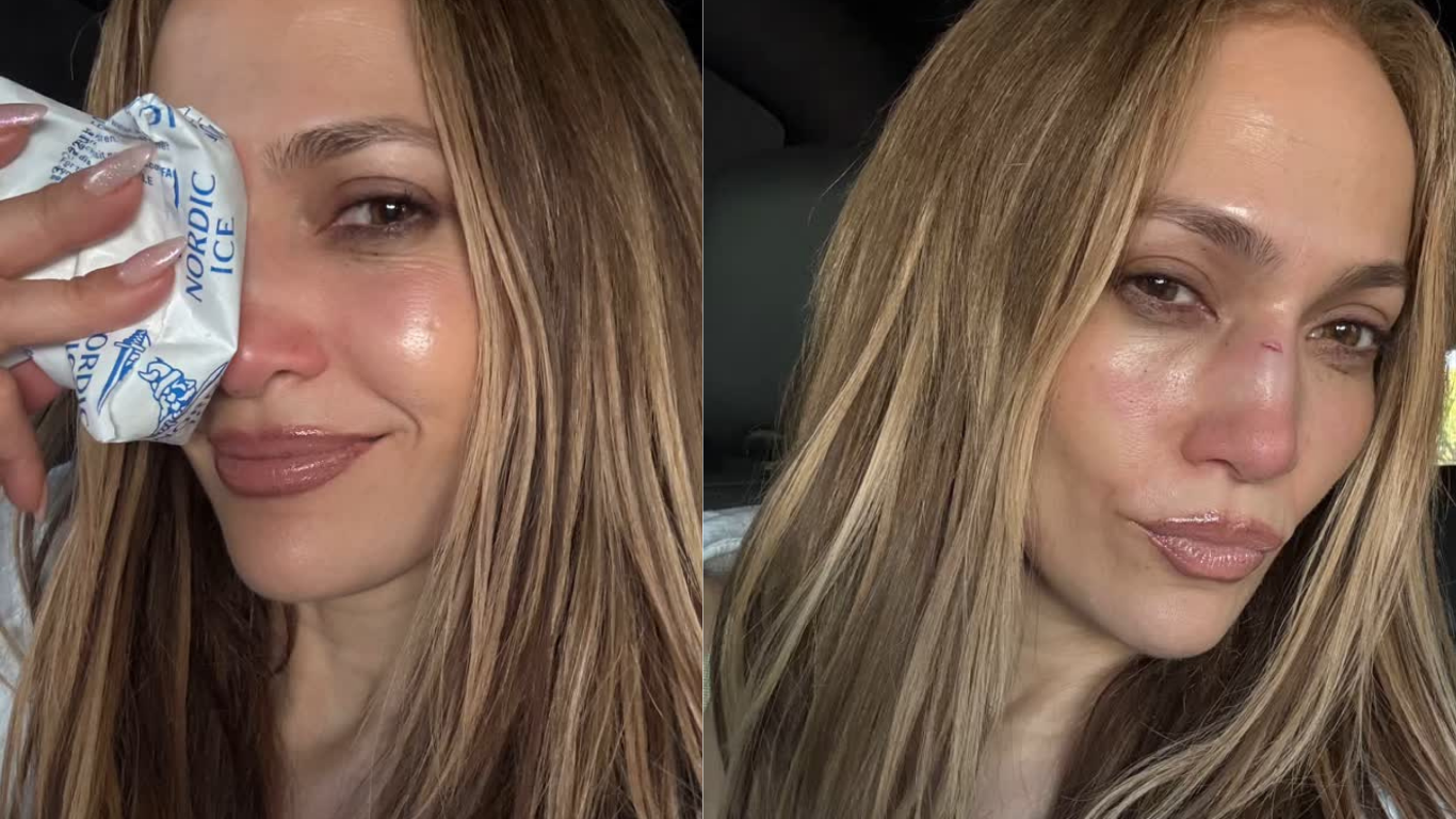 Jennifer Lopez se machuca e precisa de pontos após ensaio de premiação ...