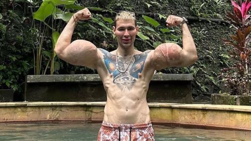 "Foi uma grande lição", diz influenciador que precisou "retirar o ...