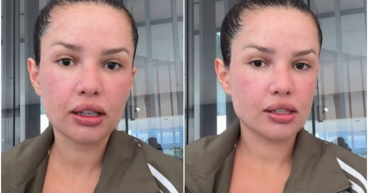 Juliette mostra rosto após procedimento com esperma de salmão; veja ...