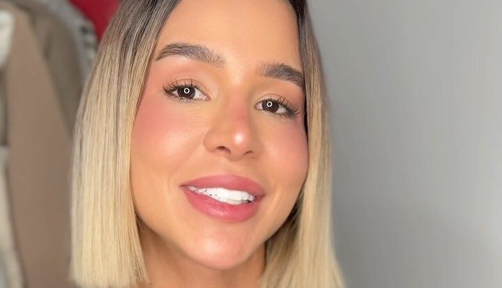 Ex-BBB Kerline mostra resultado de rinoplastia; veja antes e depois ...