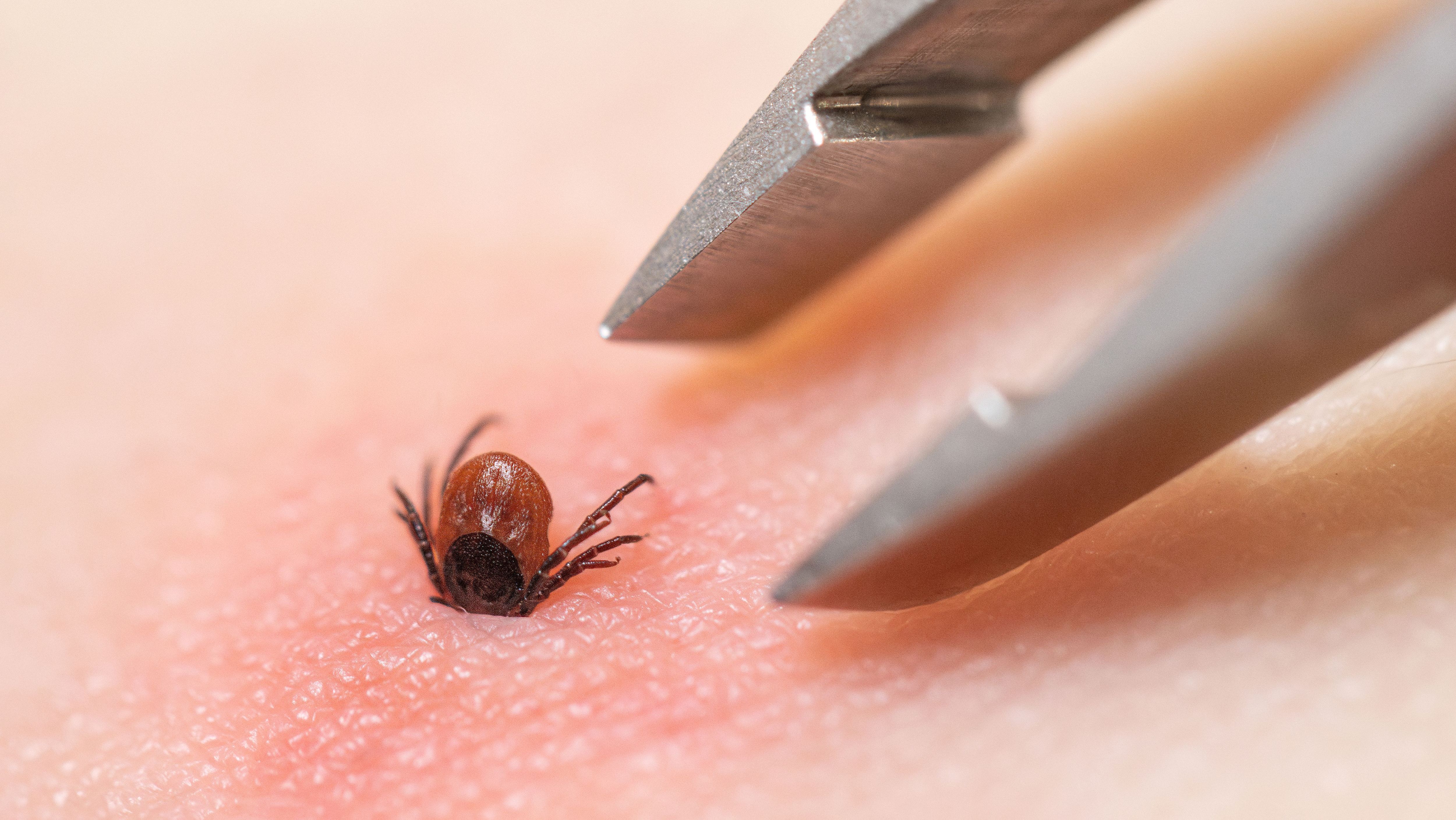 Clima mais quente e úmido tem feito subir os casos de doença de Lyme ...