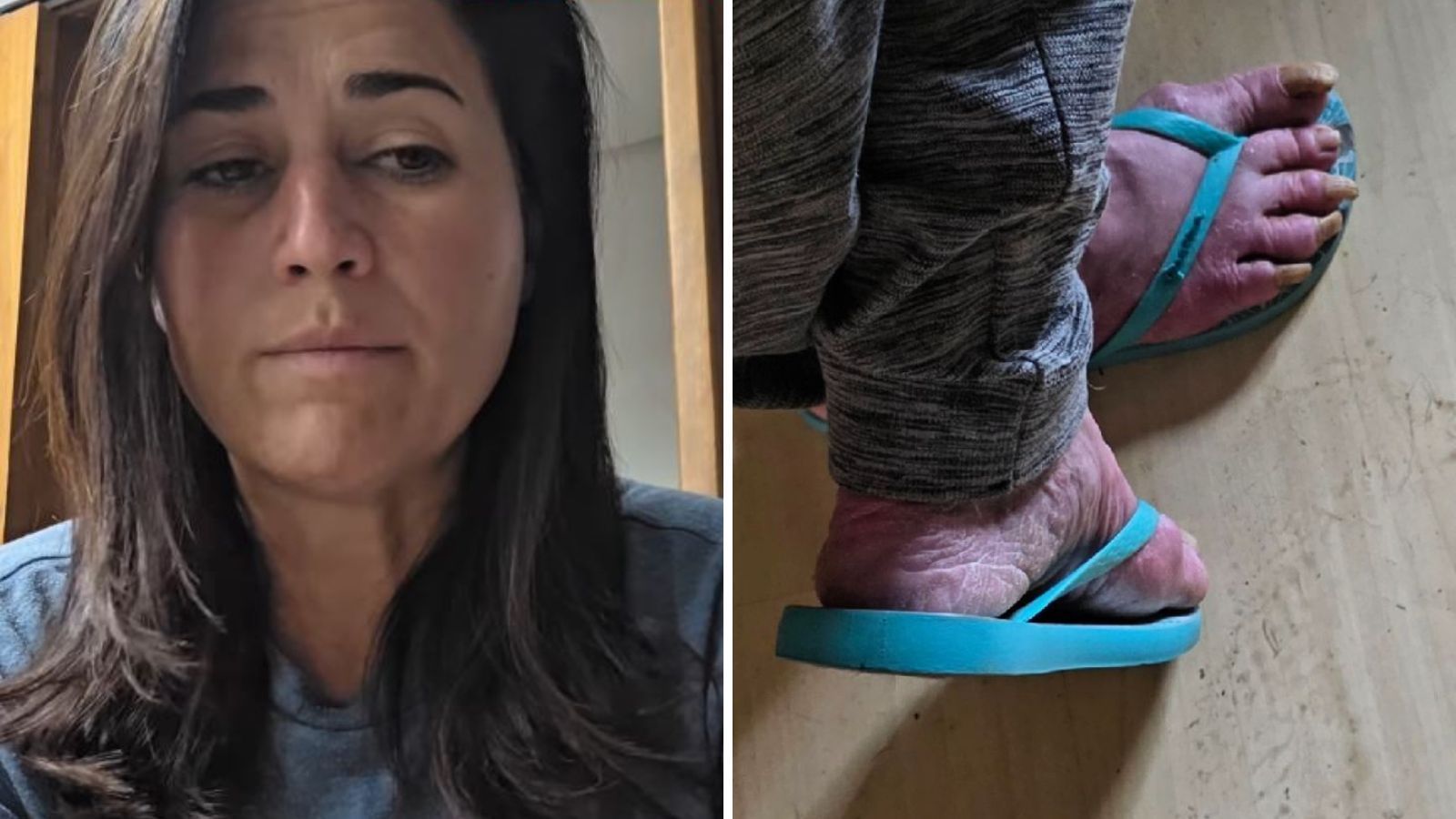 Rejane Schumann é encontrada em situação precária; ativista pede ajuda ...