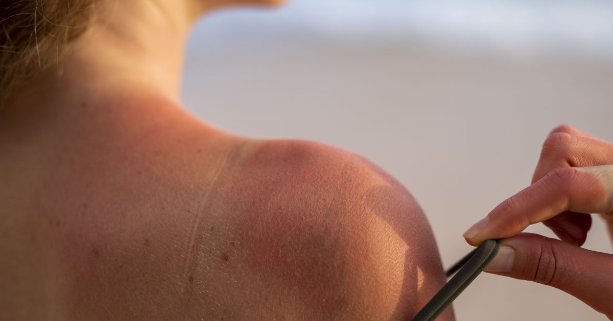 Tan Maxxing: por que fugir da trend do bronzeado extremo? | CNN Brasil