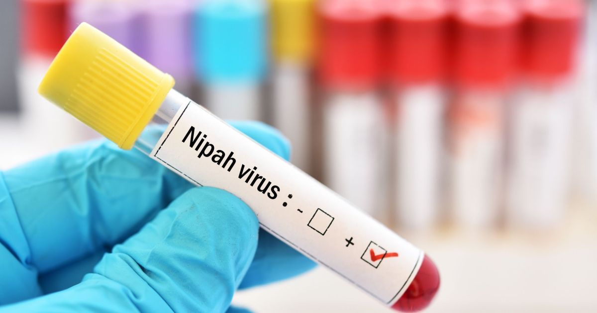 Vírus Nipah: tudo o que já se sabe sobre o vírus mortal | CNN Brasil